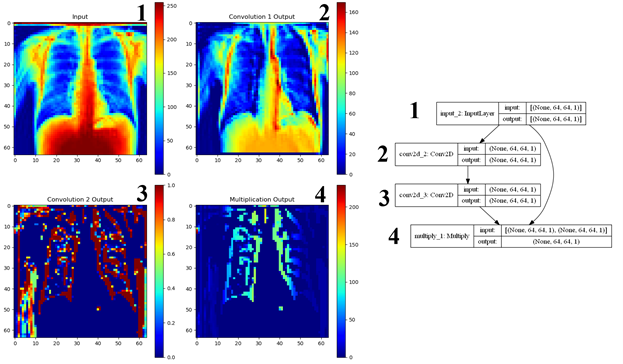 An Attention Based Residual Connection Convolutional Neural Network For Classification Of The