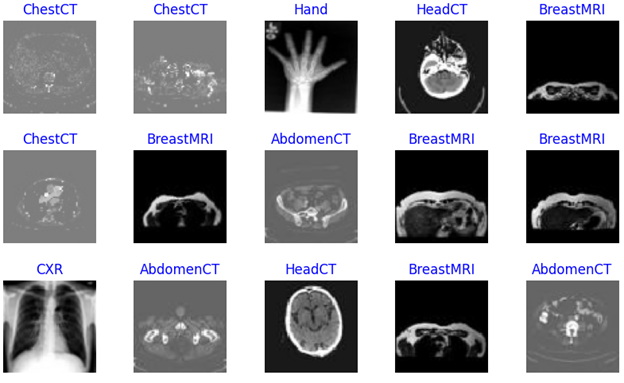 An Attention Based Residual Connection Convolutional Neural Network For Classification Of The
