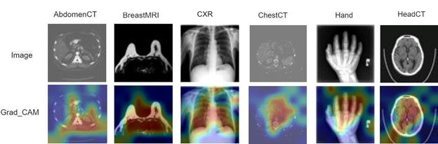 An Attention Based Residual Connection Convolutional Neural Network For Classification Of The
